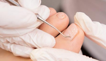 Medi Pedi VS Classic Pedi – The Summit Skin Care & Hair Removal