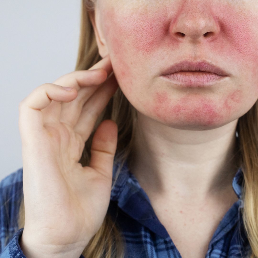 Sensitive Skin Collection – The Summit Skin Care & Hair Removal